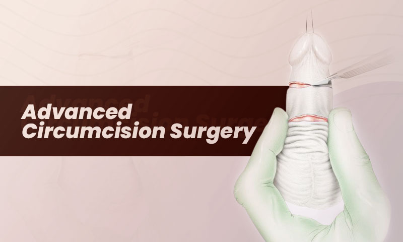 Circumcision